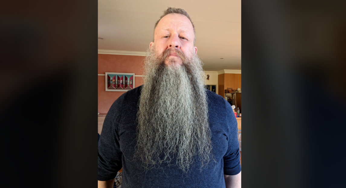 18 Beard Fails That Went Hilariously Wrong