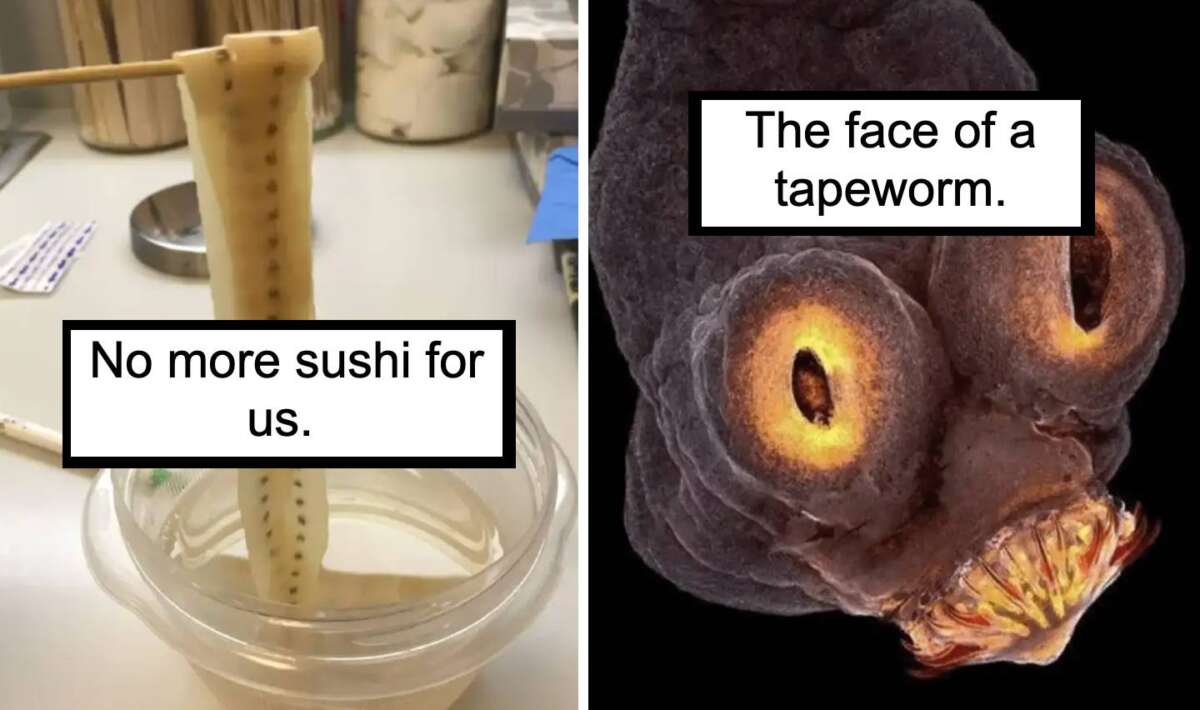 20 Horrific Parasites That Crawled Out of Nightmares